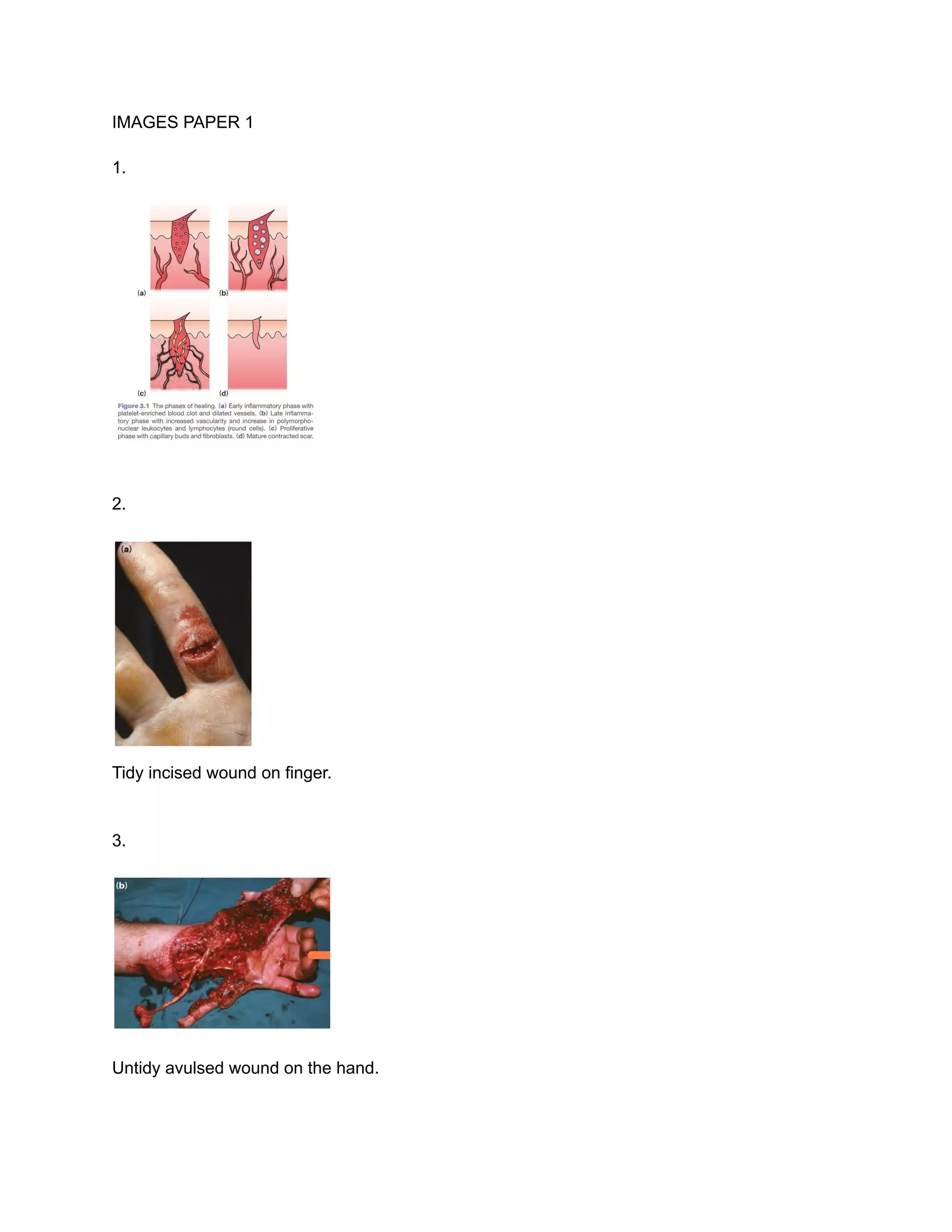 SURGERY IMAGES 1.pdf