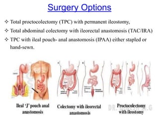 Surgery in cancer prevention | PPT