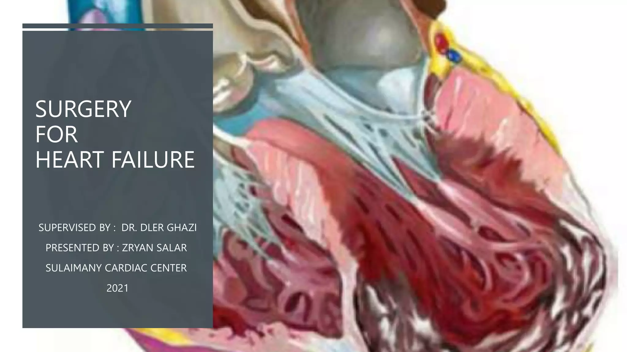 Surgery in Heart Failure | PPTX