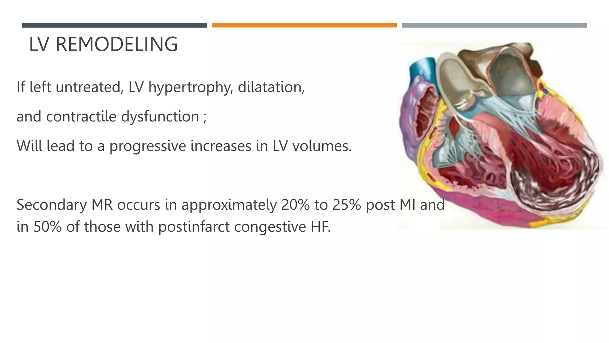 Surgery in Heart Failure | PPTX