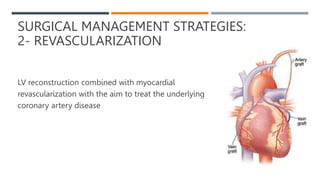 Surgery in Heart Failure | PPTX