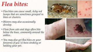 Surgery insects bites | PPTX | Infectious Diseases | Diseases and ...