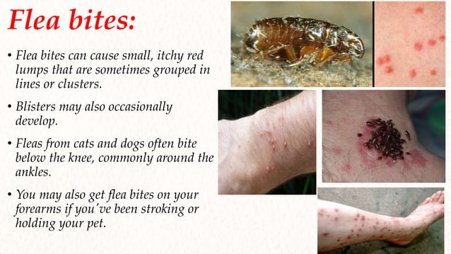 Surgery insects bites | PPT