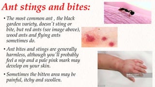 Surgery insects bites | PPTX