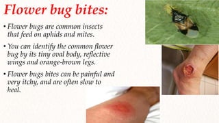 Surgery insects bites | PPTX | Infectious Diseases | Diseases and ...