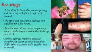 Surgery insects bites | PPTX | Infectious Diseases | Diseases and ...
