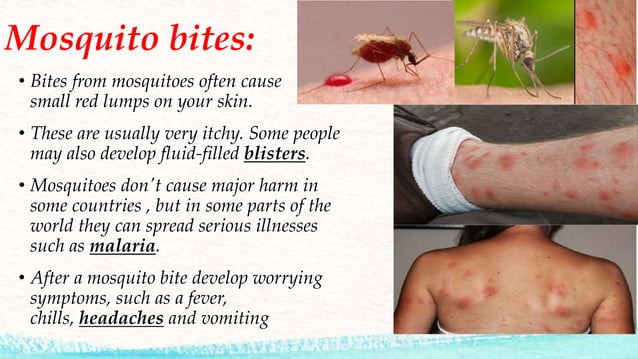 Surgery insects bites | PPTX | Infectious Diseases | Diseases and ...