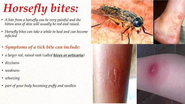 Surgery insects bites | PPTX | Infectious Diseases | Diseases and ...