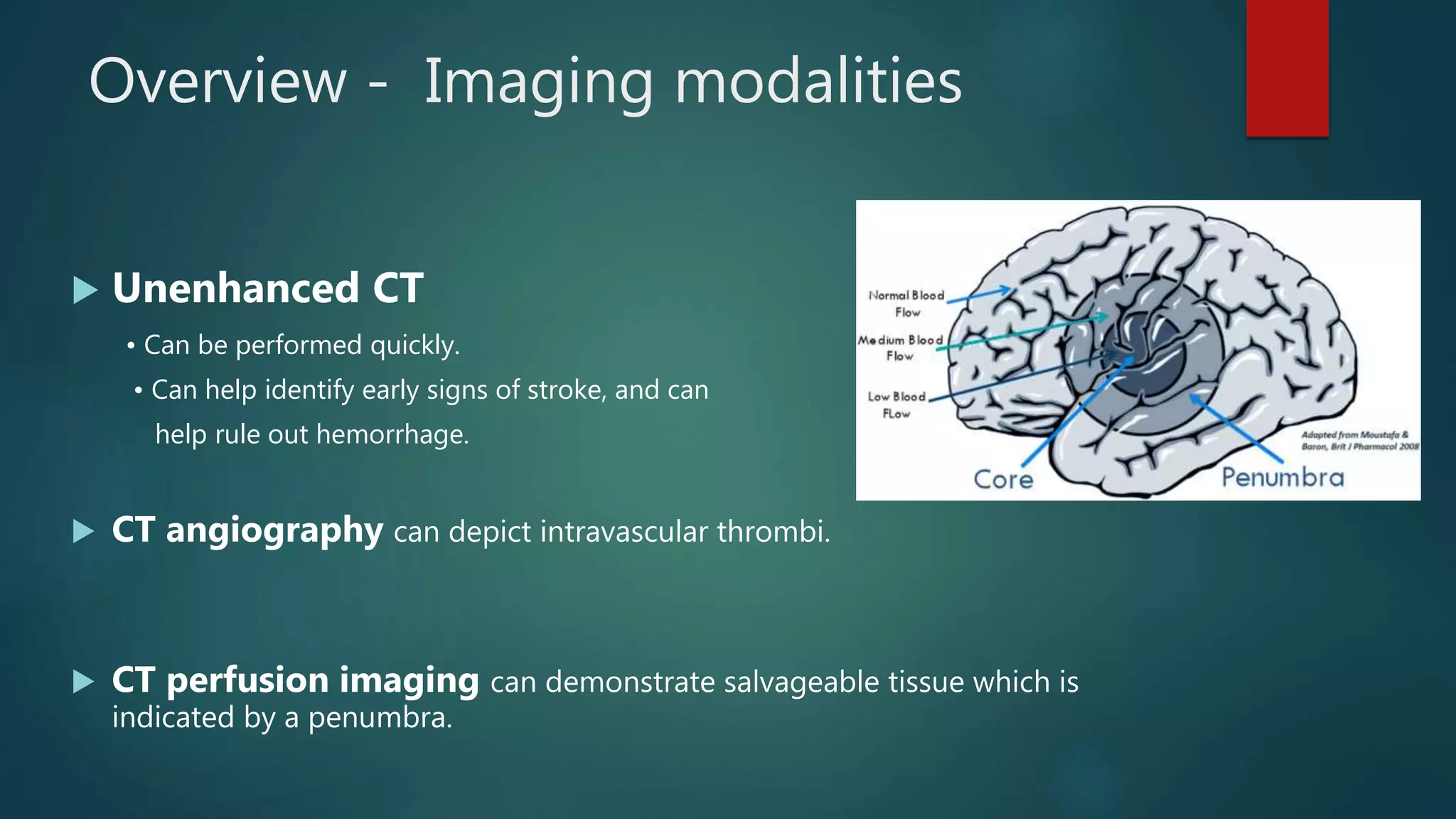 Medical Radiological and Surgical Management of Stroke | PPTX