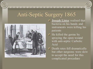 Surgery in the middle ages.pptx