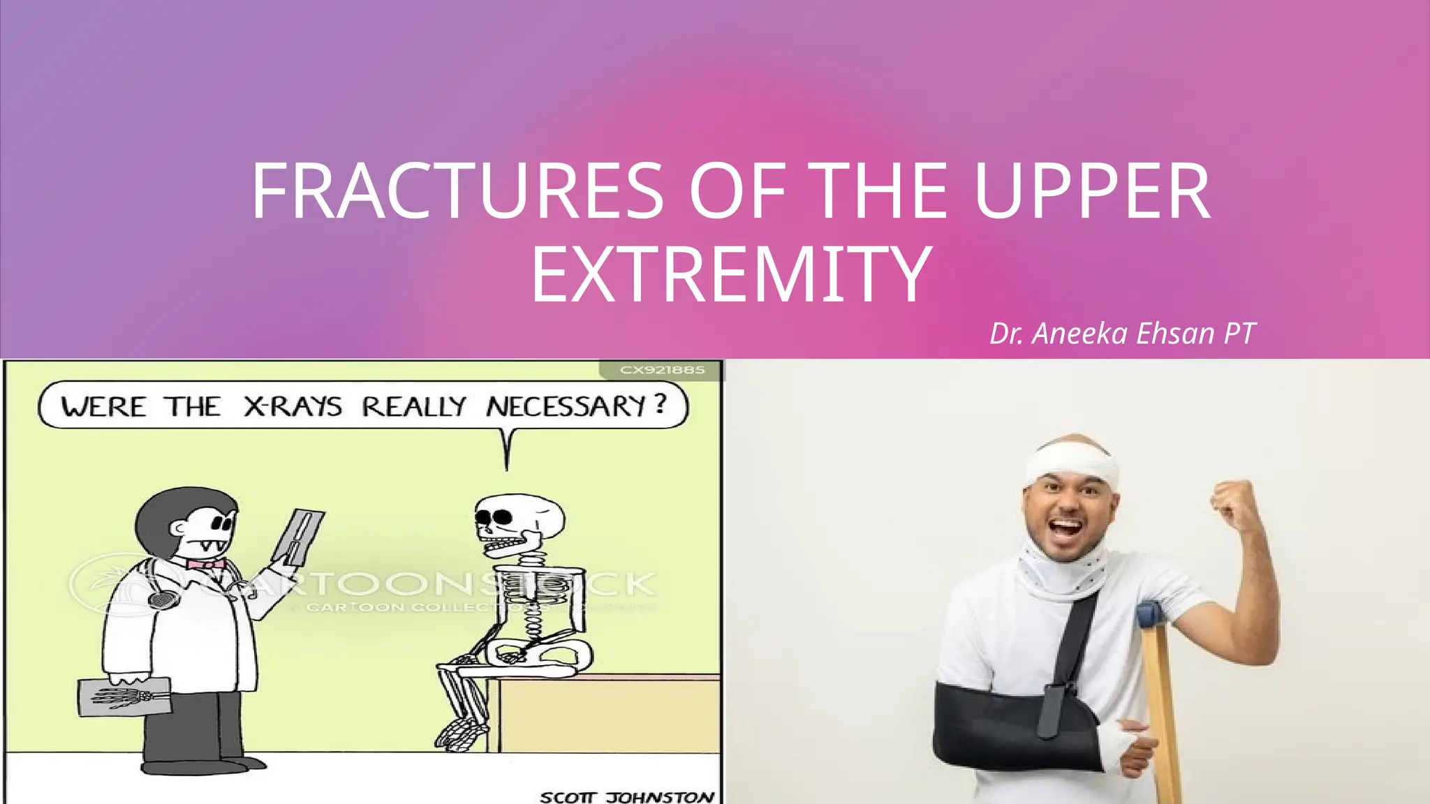 Fractures of Upper Extremity.pptx / Humerus fracture, colle's fracture ...