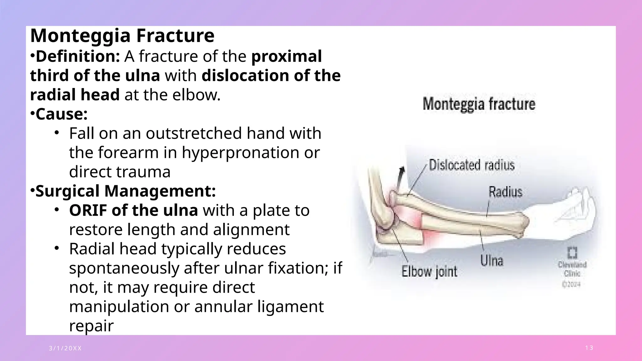 Fractures of Upper Extremity.pptx / Humerus fracture, colle's fracture ...