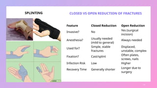 Fractures of Upper Extremity.pptx / Humerus fracture, colle's fracture ...