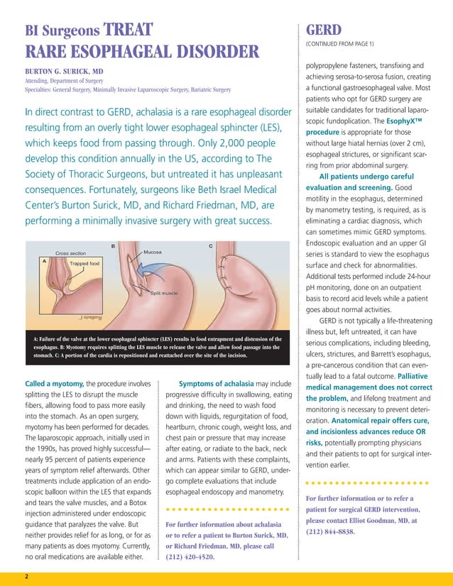 Surgery for GERD | PDF | Digestive Disorders | Diseases and Conditions