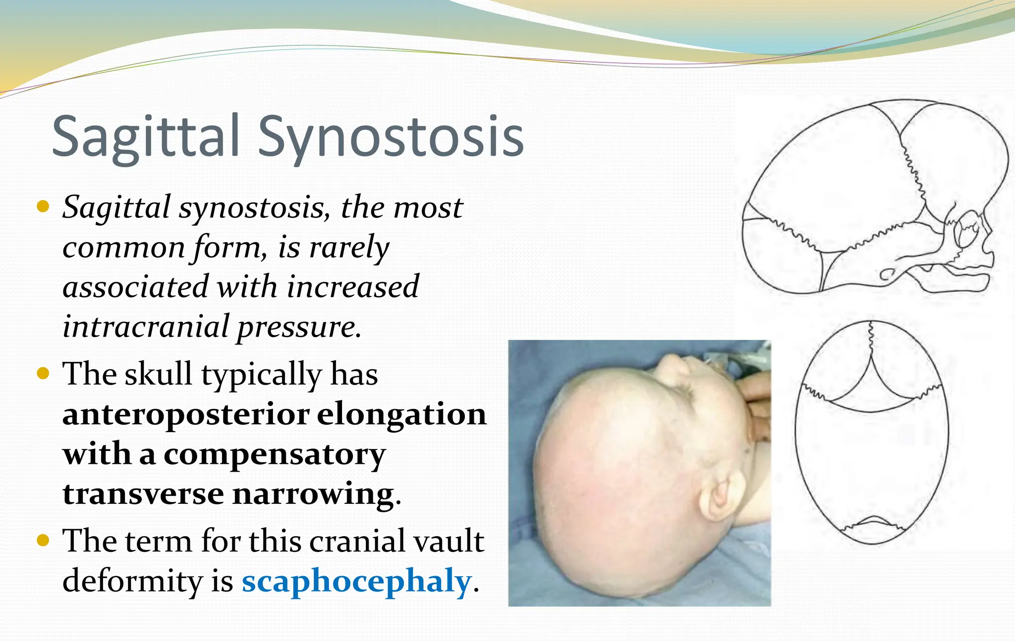 SURGERY OF CRANIOFACIAL ANOMALIES.pptx