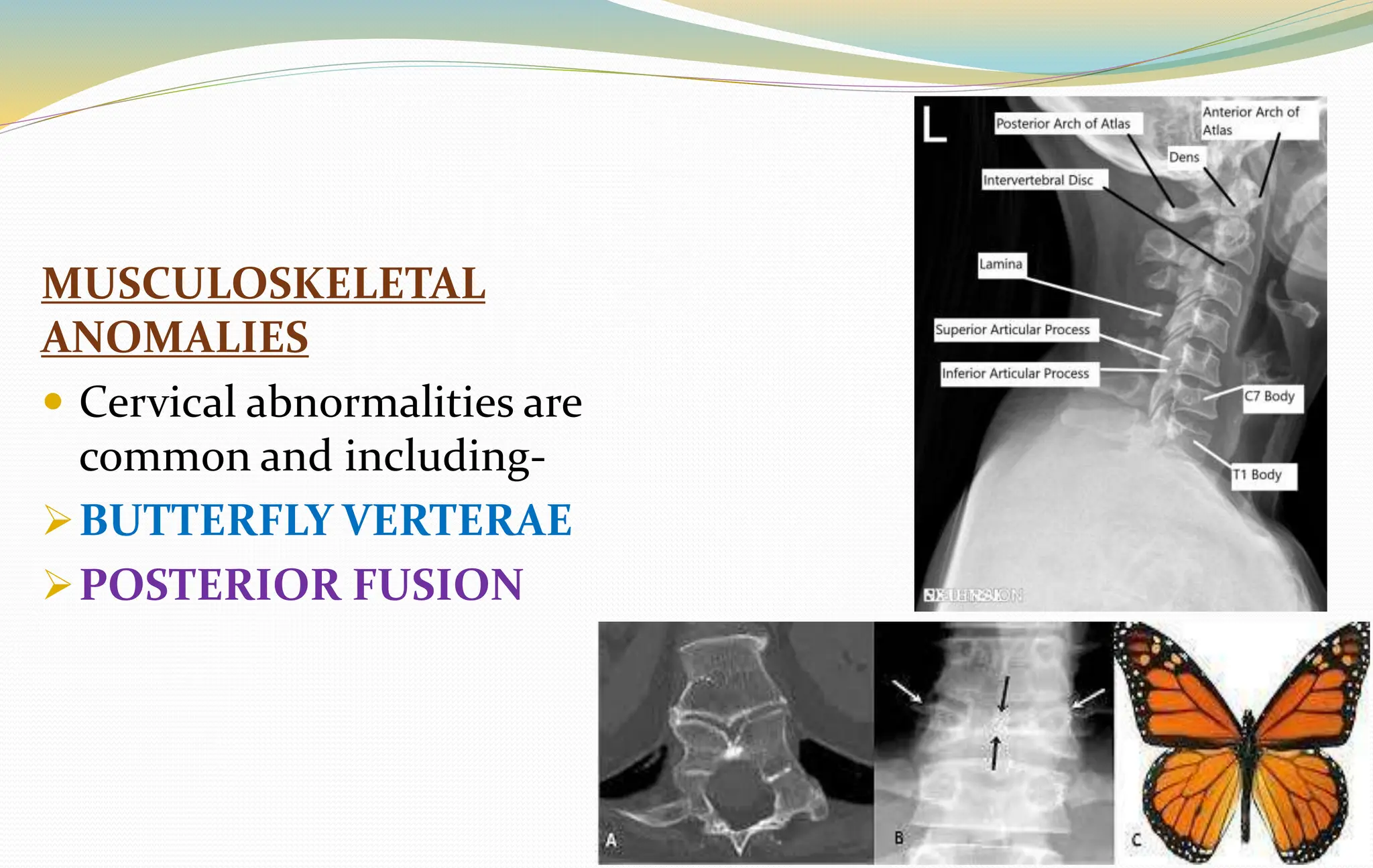 SURGERY OF CRANIOFACIAL ANOMALIES.pptx