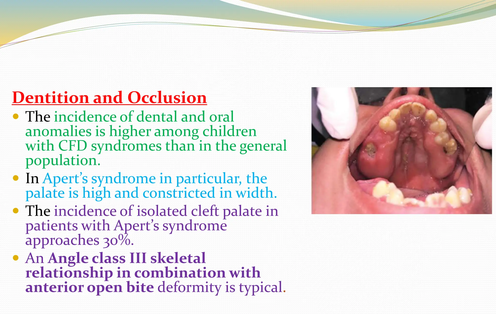 SURGERY OF CRANIOFACIAL ANOMALIES.pptx