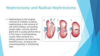 Surgery of renal/ urinary system | PPTX