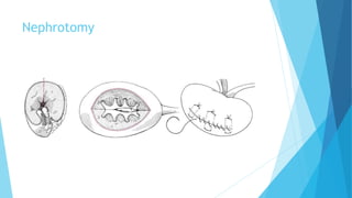 Surgery of renal/ urinary system | PPTX