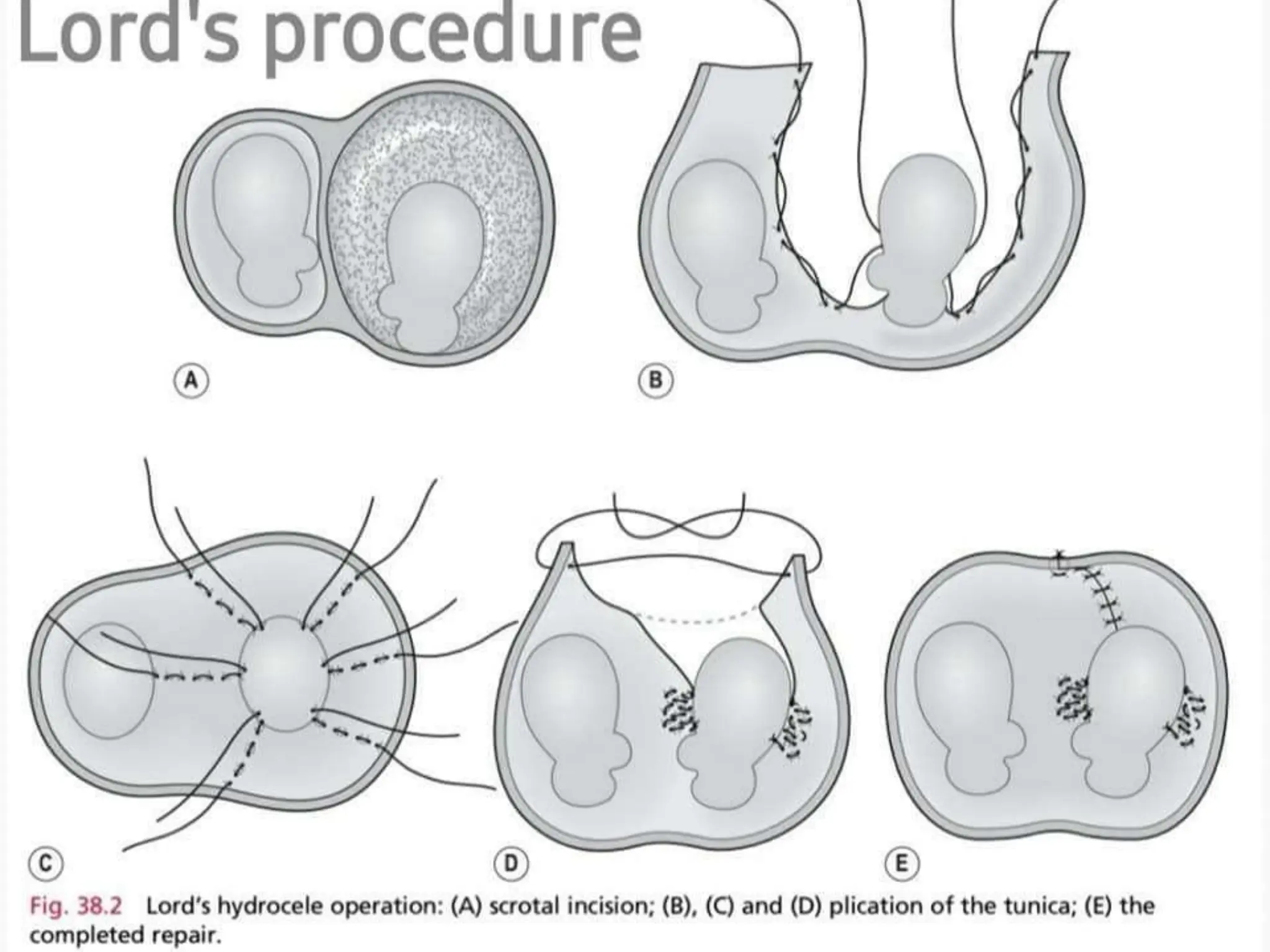 Surgery Operative Procedures 1.pptx