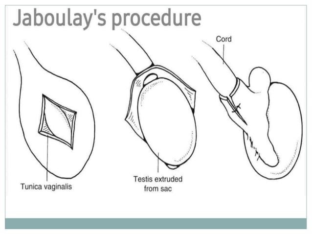 Surgery Operative Procedures 1.pptx
