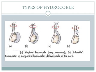Surgery Operative Procedures 1.pptx