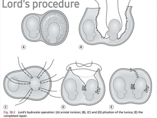Surgery Operative Procedures 1.pptx