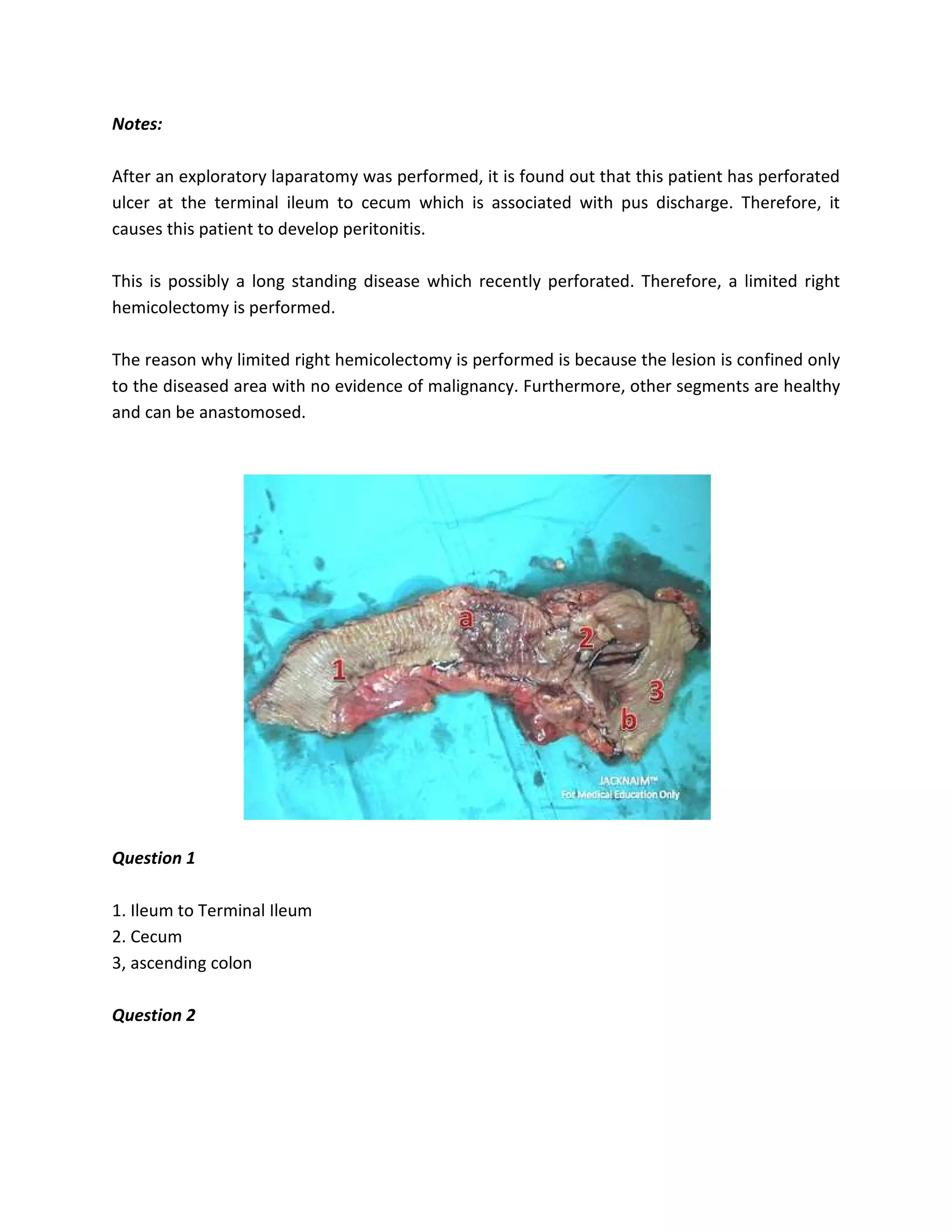 Surgery Osce Quiz 2 | PDF