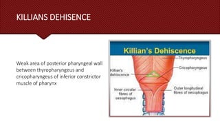 surgery ppt ashish isheoopp jiwhfjsosh jioa | PPTX