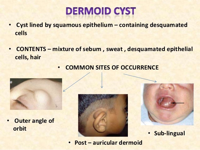 Benign Skin Swellings