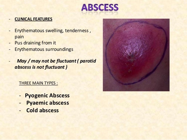 Benign Skin Swellings