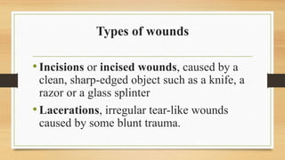 Surgery presentation | PPT