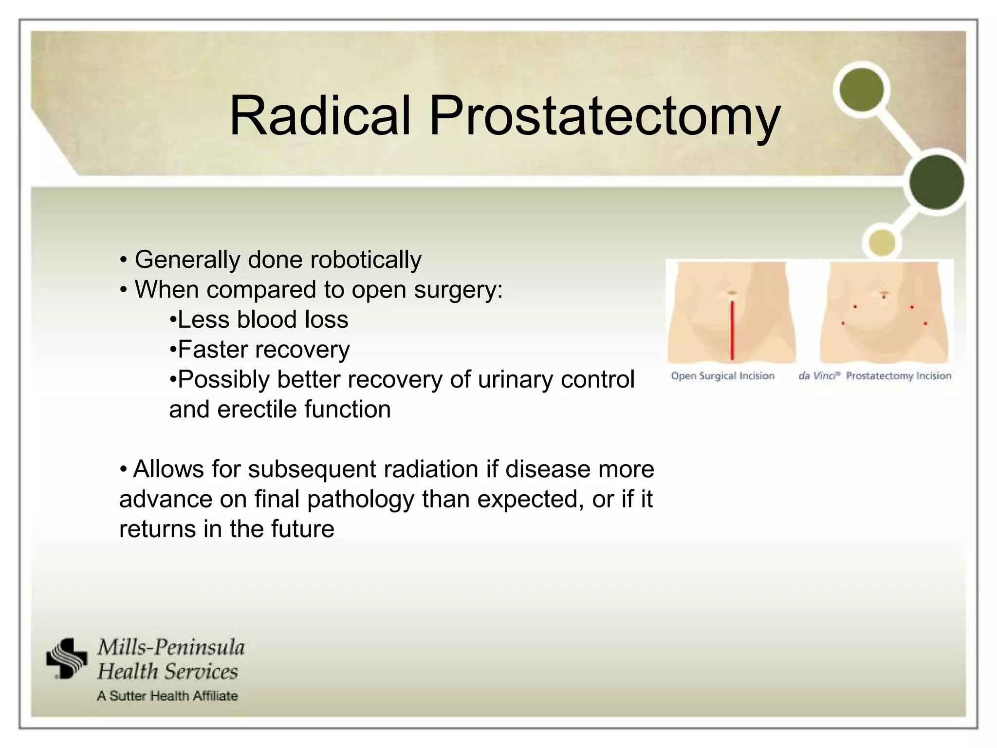 Surgery, radiation therapy or neither evolving approaches to prostate ...