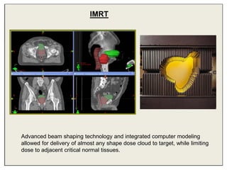 Surgery, radiation therapy or neither evolving approaches to prostate ...