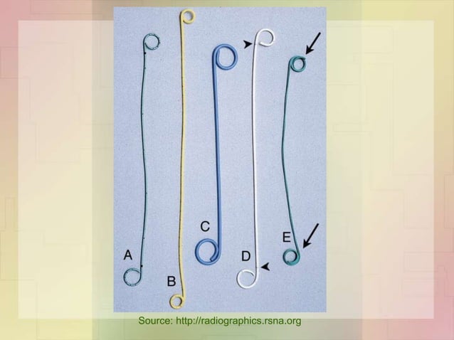 management of upper urinary obstruction | PPTX | Medical Health