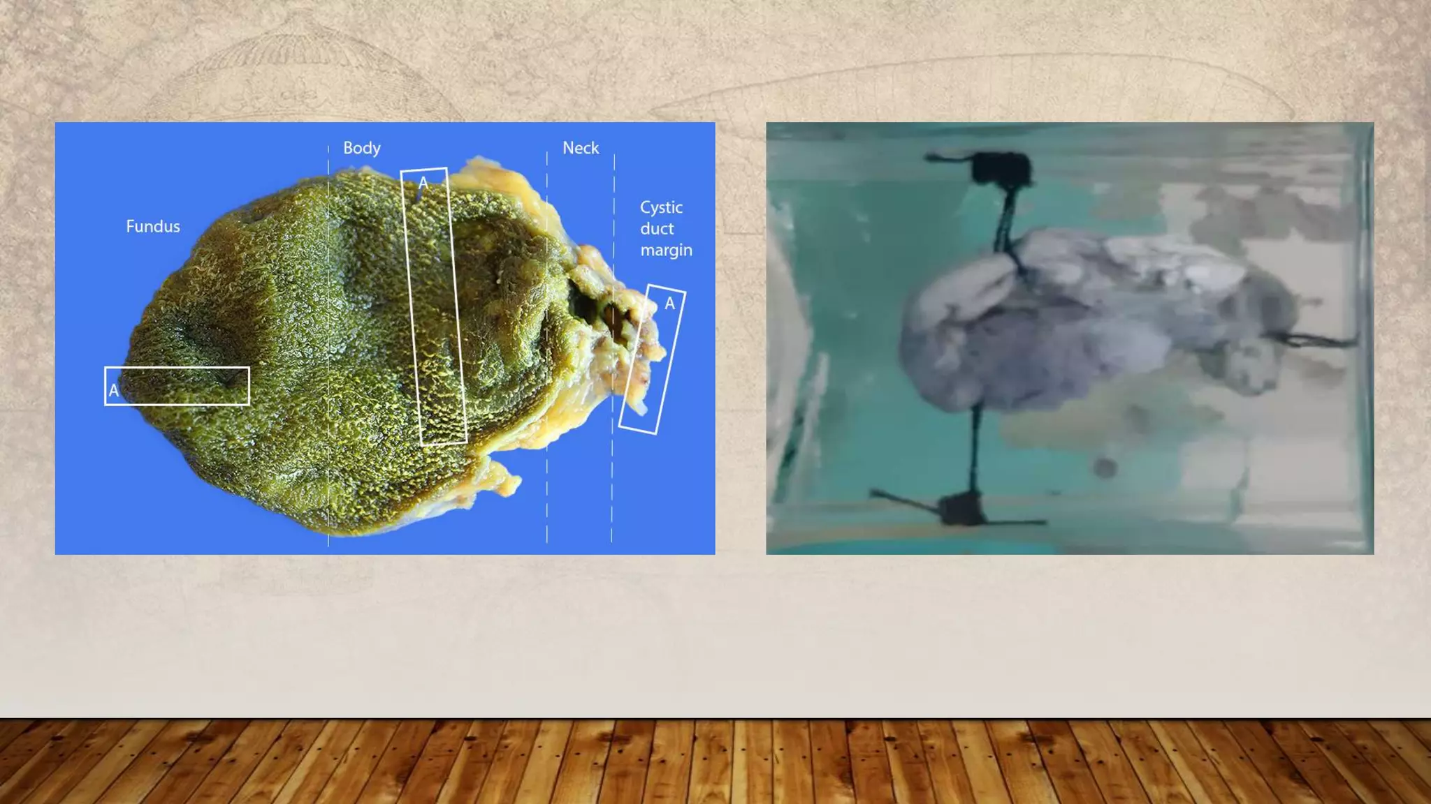 General surgery specimens | PPTX