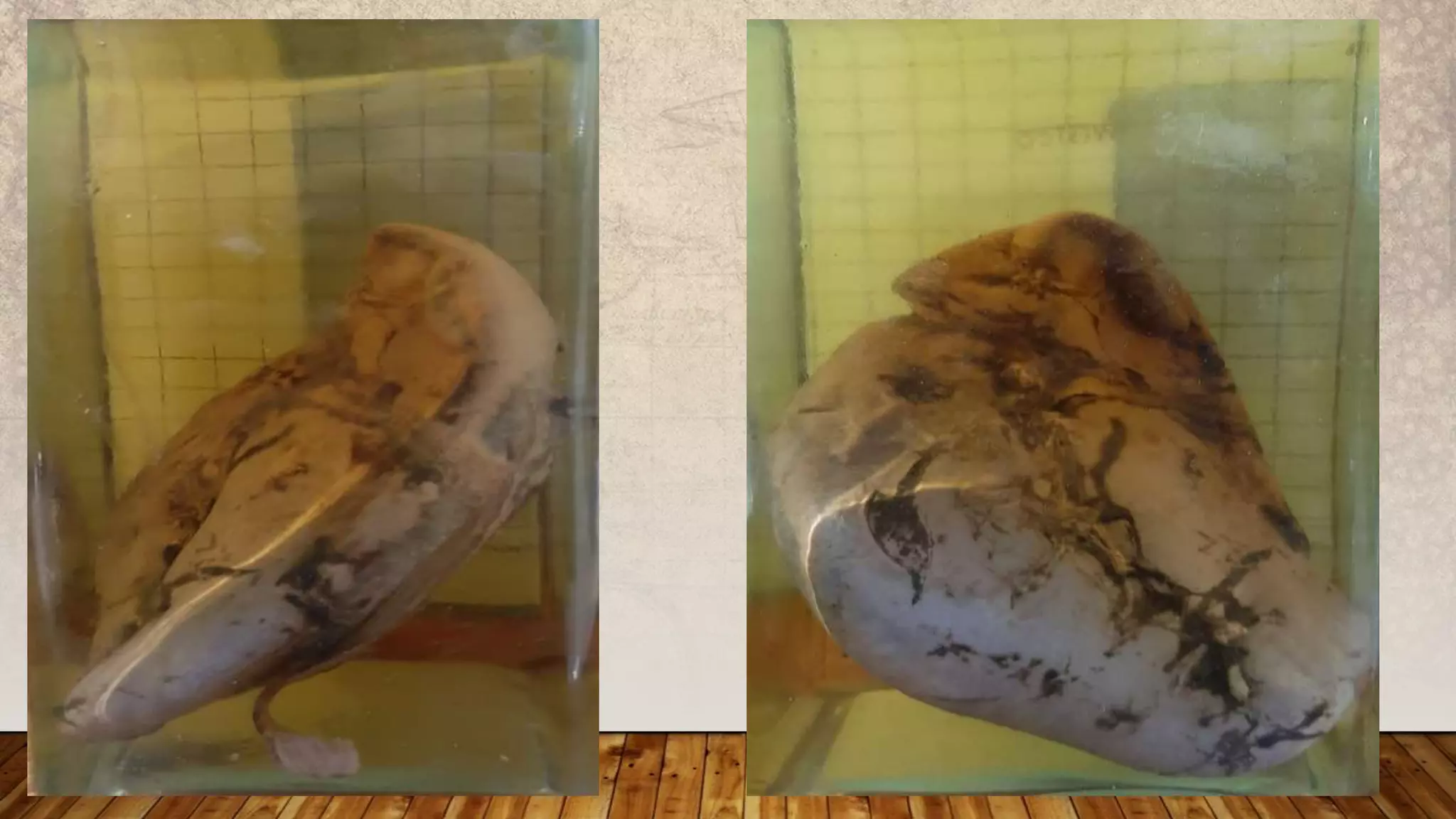 General surgery specimens | PPTX