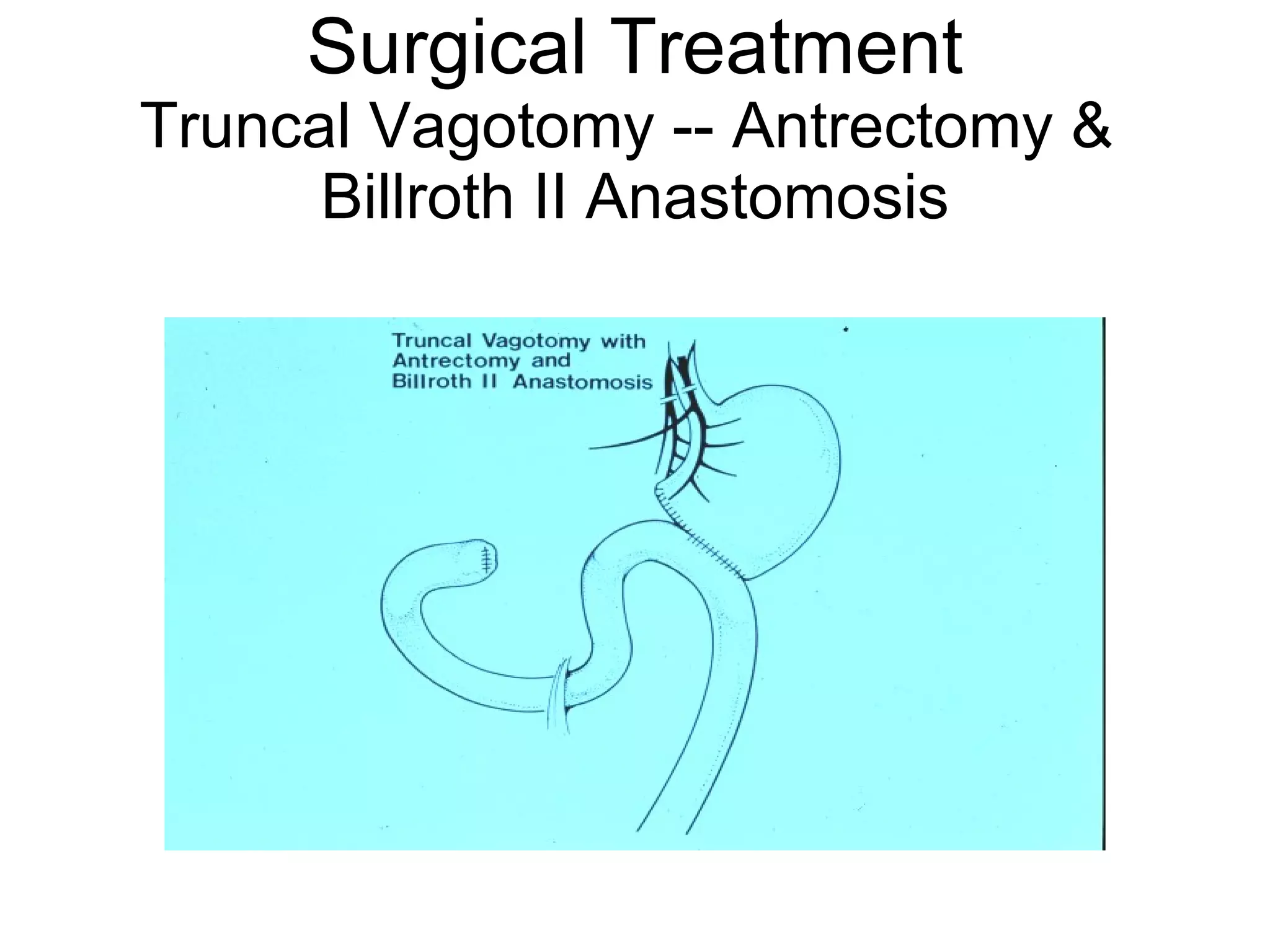 Surgery Stomach & Duodenum Tg | PPT