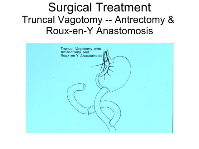 Surgery Stomach & Duodenum Tg | PPT | Digestive Disorders | Diseases ...