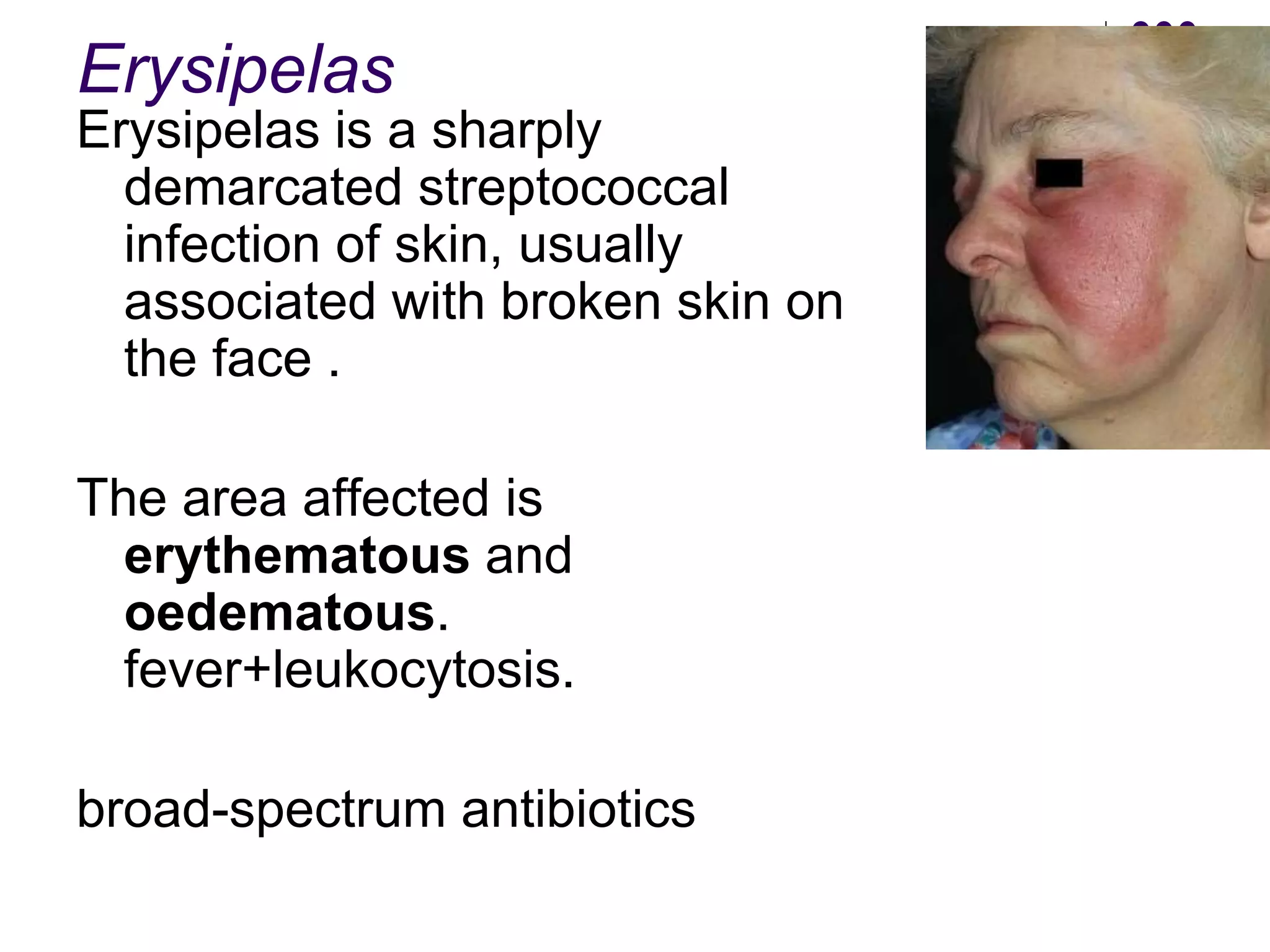 Surgery(surgical infections) 1-2 | PPT