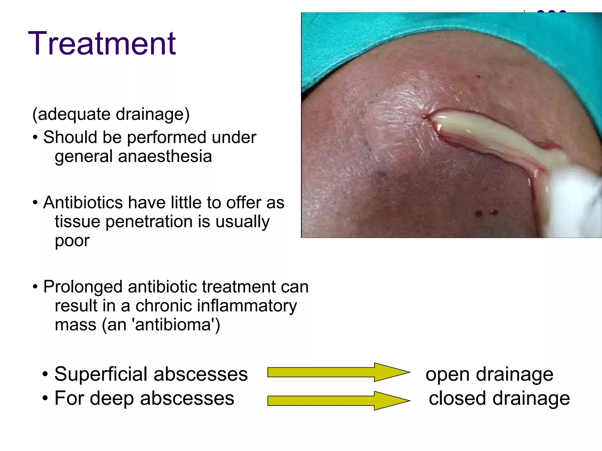 Surgery(surgical infections) 1-2 | PPT
