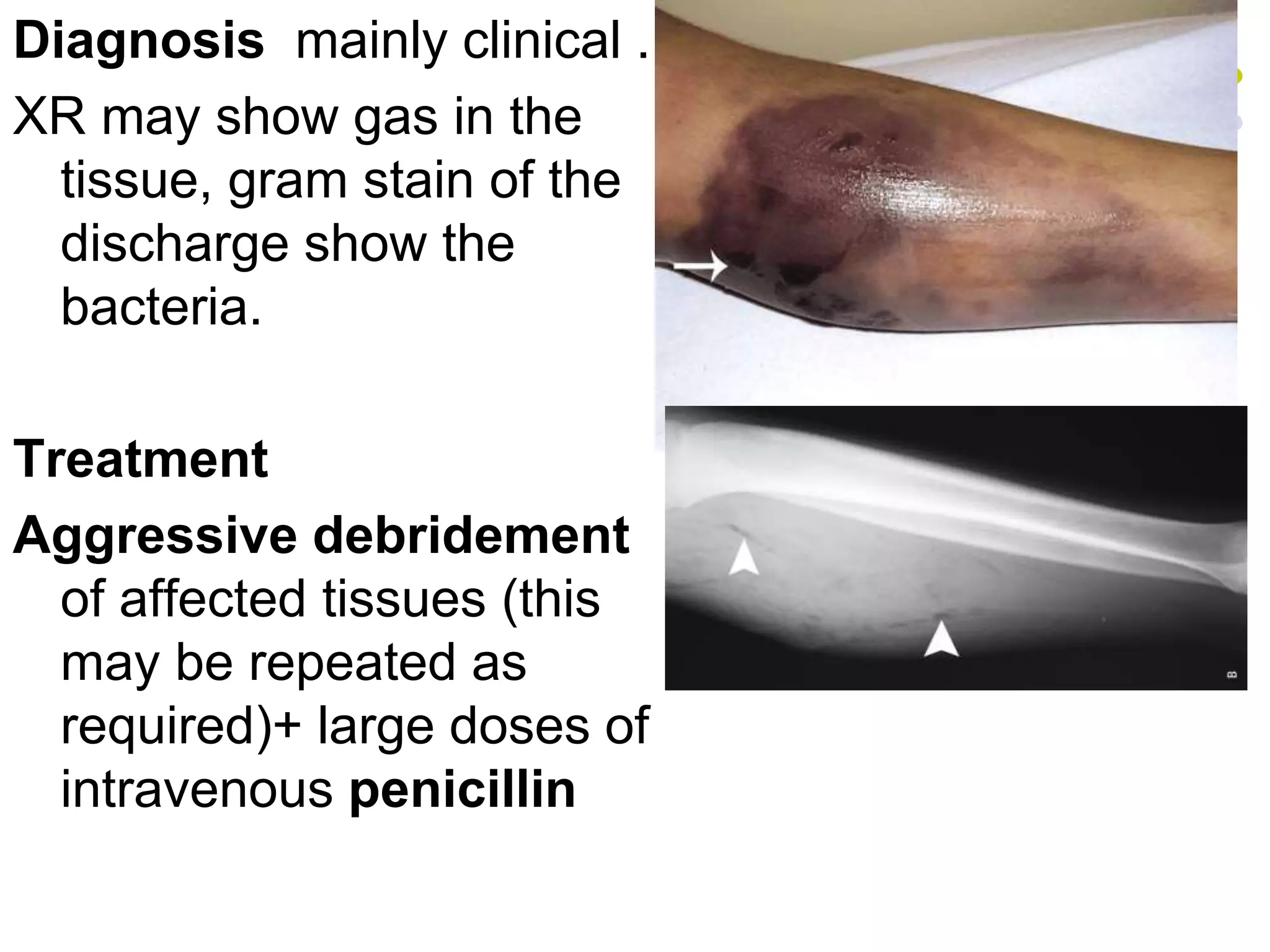 Surgery(surgical infections) 1-2 | PPT | Infectious Diseases | Diseases ...