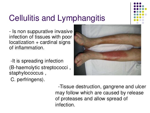 Surgery(surgical infections) 1-2