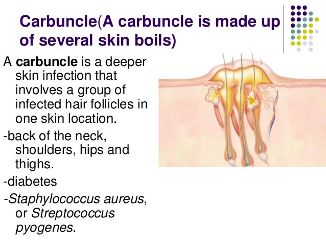 Surgery(surgical infections) 1-2