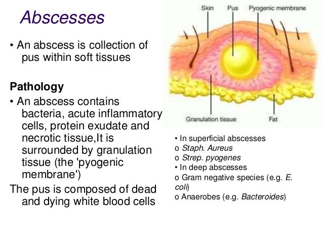 Surgery(surgical infections) 1-2