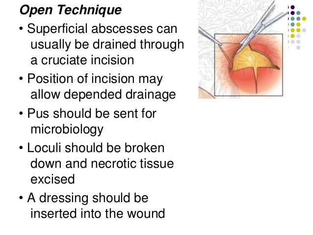 Surgery(surgical infections) 1-2
