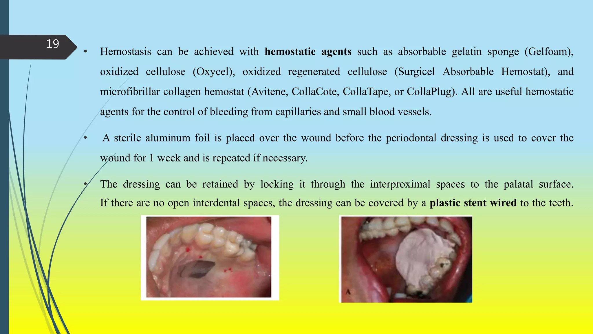 SURGERY TO INCREASE WIDTH OF ATTACHED GINGIVA.pptx