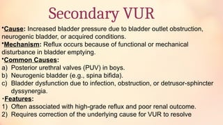 surgery and Vesicourteric reflux disease | PPTX