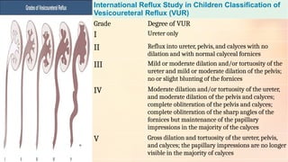 surgery and Vesicourteric reflux disease | PPTX