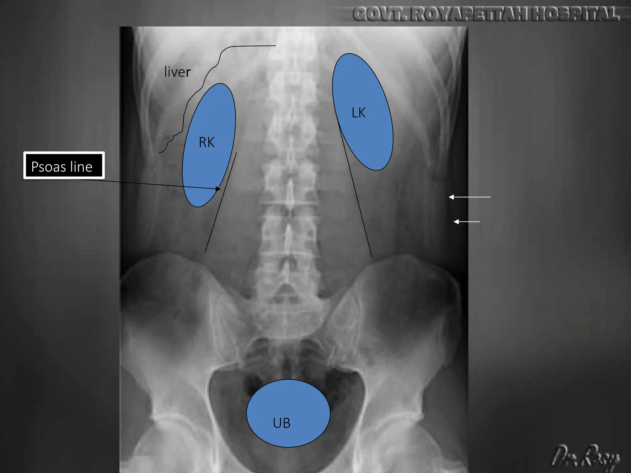Surgery_XRays basic xray findings in general surgery mbbs.pptx
